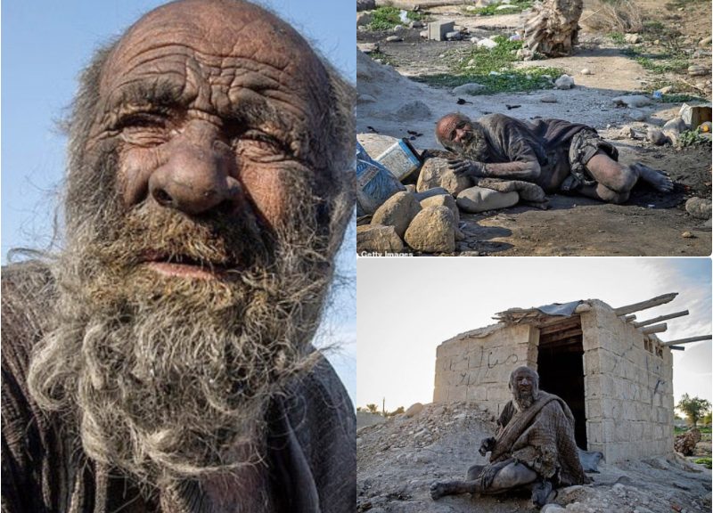 World's Dirtiest Man Dies After Taking His First Bath In 60 Years