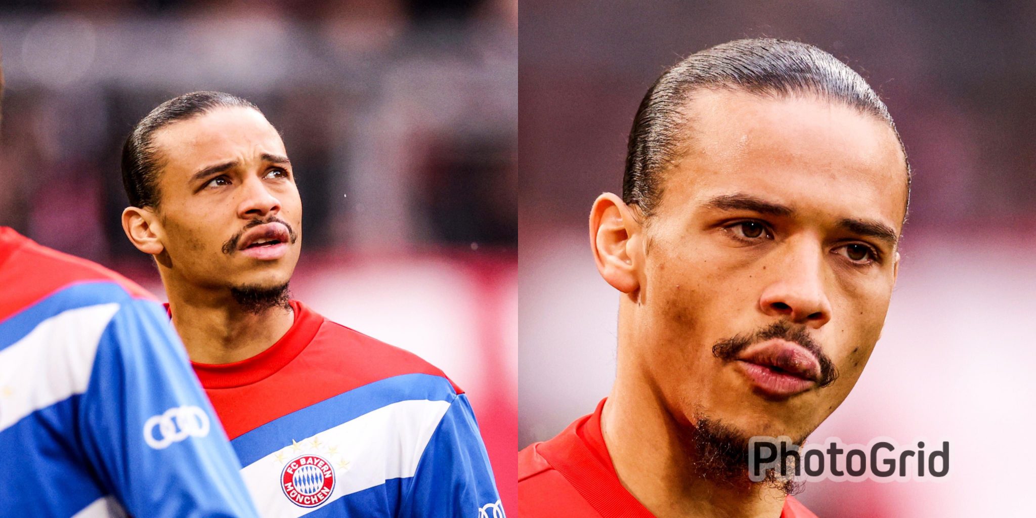 Leroy Sane Spotted With A Wounded Lips After Sadio Mane’s ‘Superman’ Punch